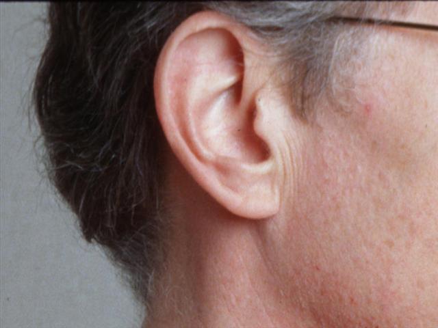 Pittsburgh man bit off another man's ear during argument about Trump ...